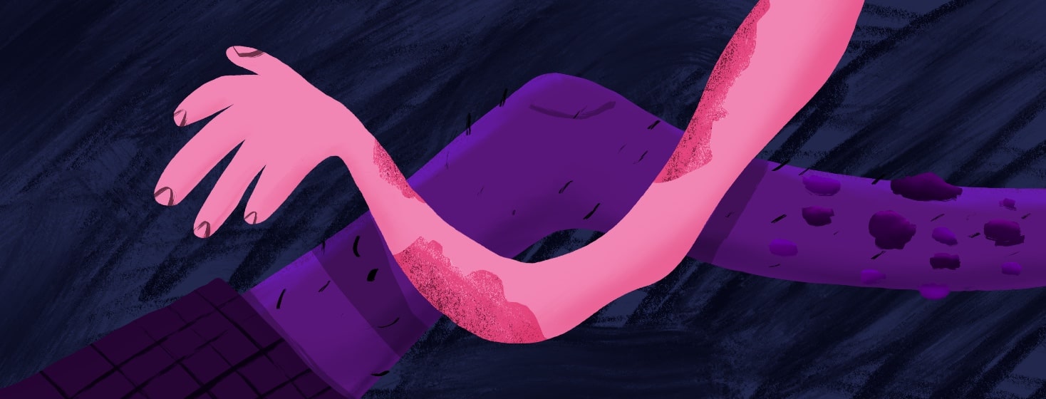 Skin Rash Caused By Crohn's Disease at Susan Villanueva blog