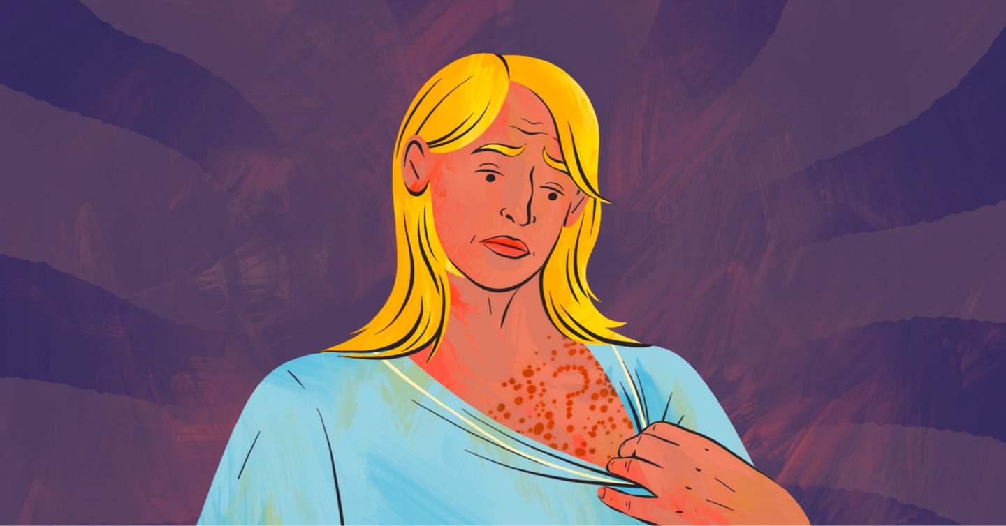 What Rashes Or Skin Conditions Are Caused By Crohn's?