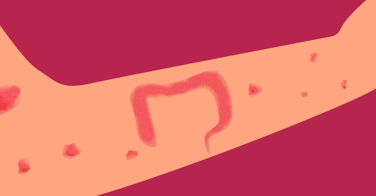 What Rashes Or Skin Conditions Are Linked To Ulcerative Colitis?