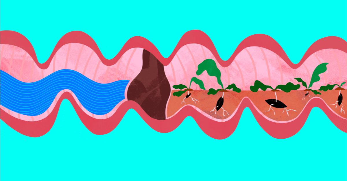 How Do You Know When You Have A Crohn's Disease Blockage?